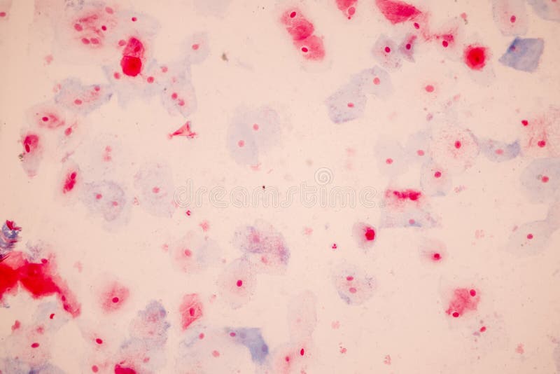 Histologisch Monster Plaveiselcel Epitheelcellen Onder Microscoop ...
