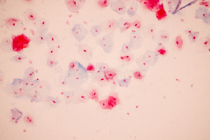 Histologisch Monster Plaveiselcel Epitheelcellen Onder Microscoop ...