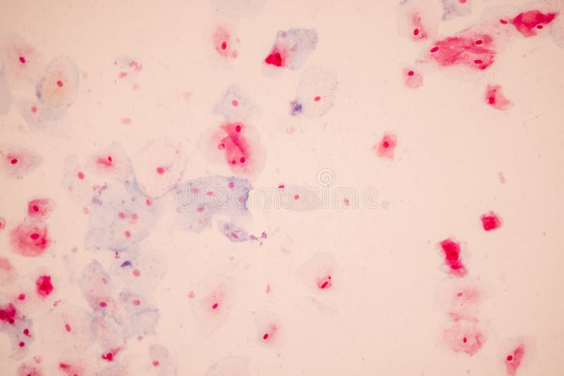 Histologisch Monster Plaveiselcel Epitheelcellen Onder Microscoop ...