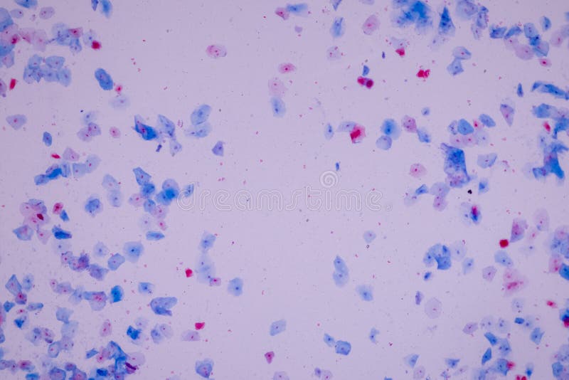 Histologisch Monster Plaveiselcel Epitheelcellen Onder Microscoop ...