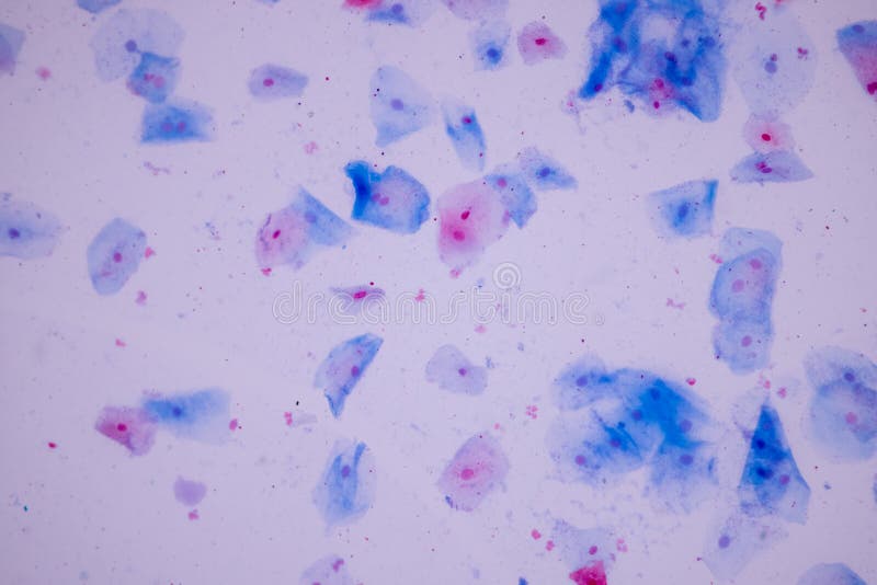 Histologisch Monster Plaveiselcel Epitheelcellen Onder Microscoop ...