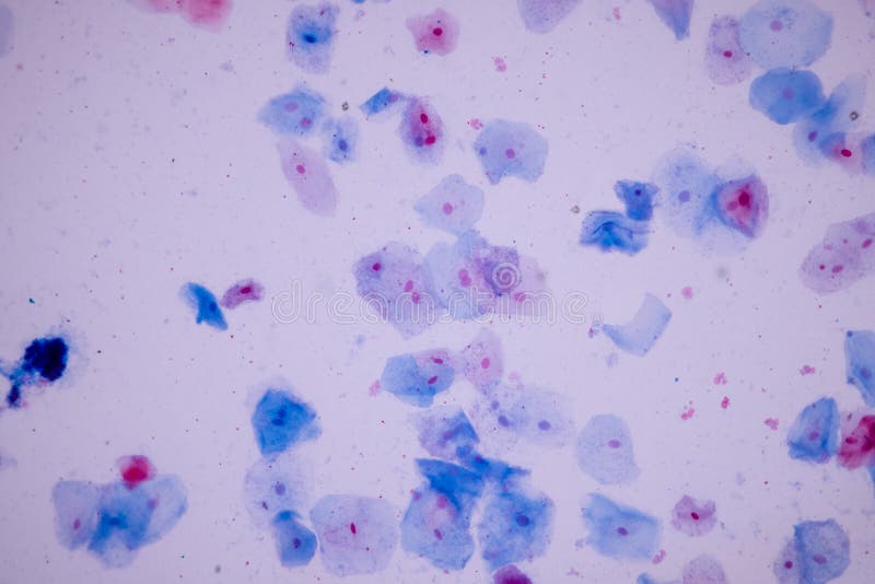 Histologisch Monster Plaveiselcel Epitheelcellen Onder Microscoop ...