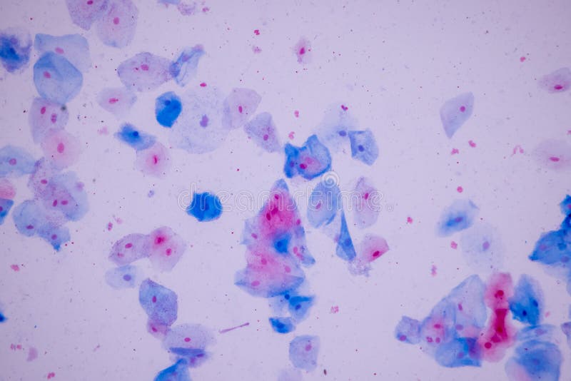 Histologisch Monster Plaveiselcel Epitheelcellen Onder Microscoop ...