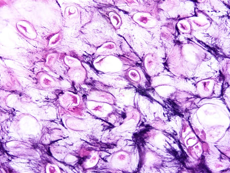Histology of Epiglottis Human Tissue Stock Photo - Image of squamous ...