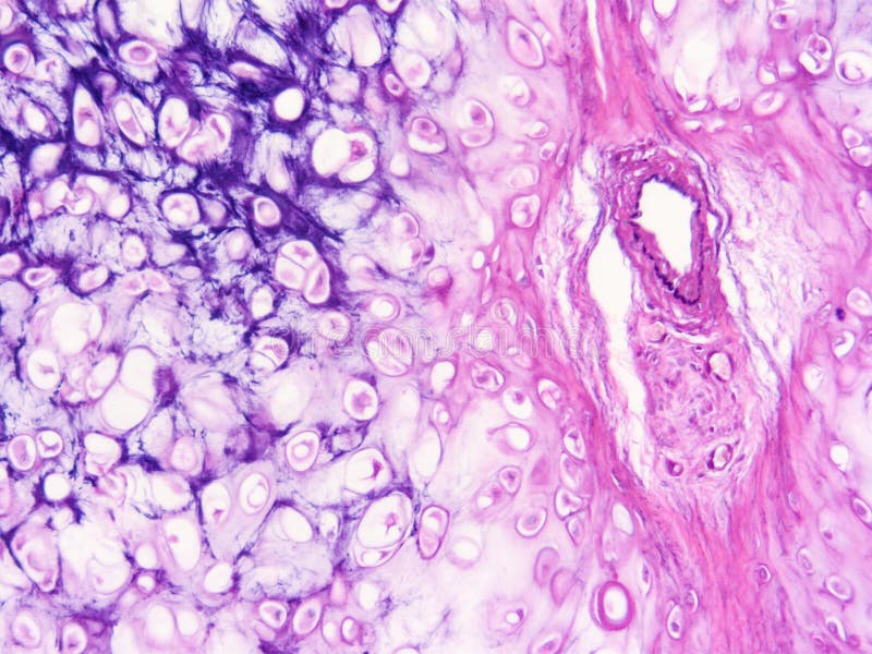 Histology of Epiglottis Human Tissue Stock Image - Image of tendon ...