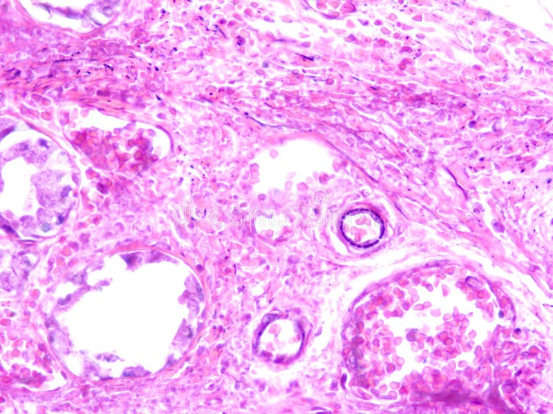 Histology of Epiglottis Human Tissue Stock Photo - Image of gland ...