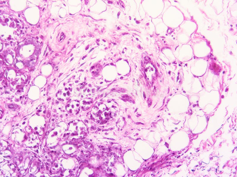 Histology of Epiglottis Human Tissue Stock Photo - Image of health ...