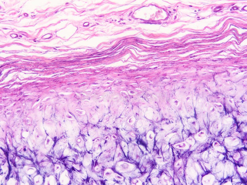 Histology of Epiglottis Human Tissue Stock Image - Image of columnar ...