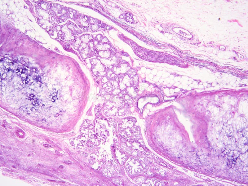 Histology Of Epiglottis Human Tissue Stock Image - Image of view, gland ...