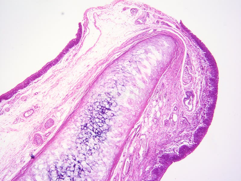 Histology of Epiglottis Human Tissue Stock Image - Image of view, show ...