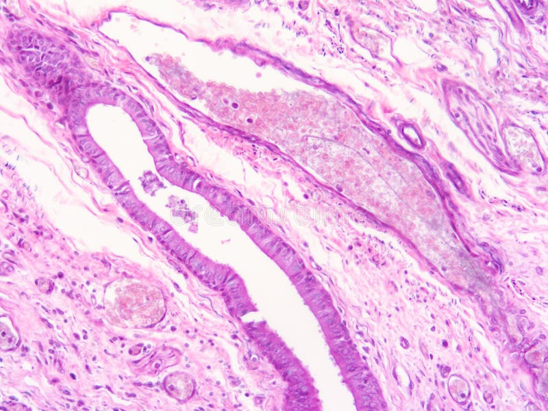 Histology Of Epiglottis Human Tissue Stock Photo - Image of pathology ...