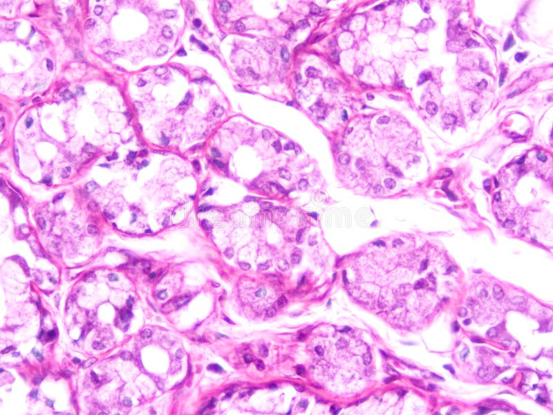 Histology of Epiglottis Human Tissue Stock Image - Image of human ...