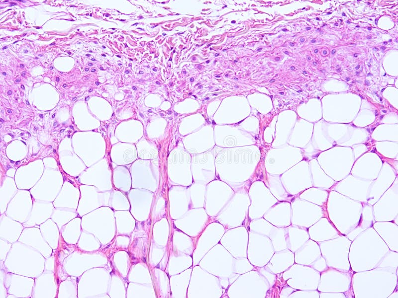 Histology of Epiglottis Human Tissue Stock Photo - Image of squamous ...