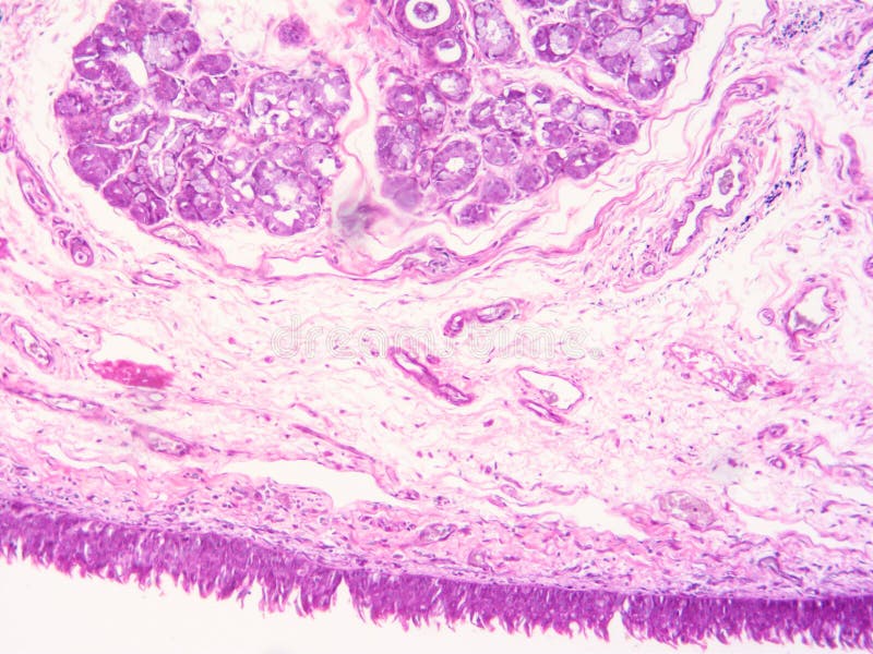 Histology of Epiglottis Human Tissue Stock Image - Image of histology ...