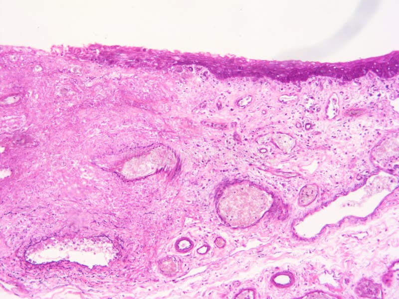 Histology of Epiglottis Human Tissue Stock Photo - Image of biology ...