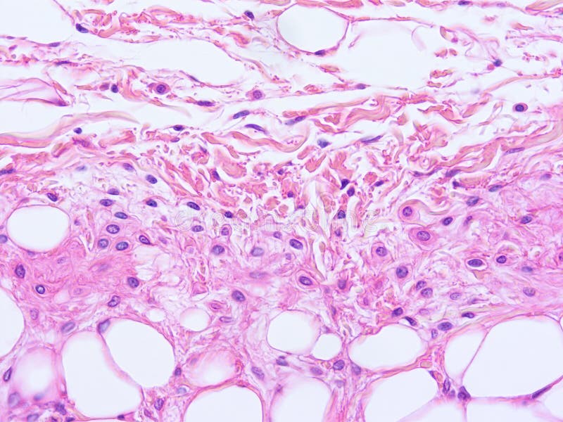 Histology Of Epiglottis Human Tissue Stock Photo - Image of cuboidal ...