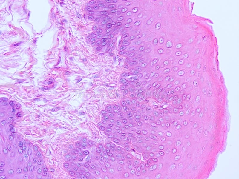 Histology Of Epiglottis Human Tissue Stock Image - Image of show ...