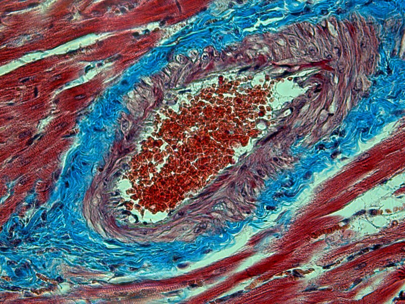 251 Heart Cells Under Microscope Stock Photos - Free & Royalty-Free ...