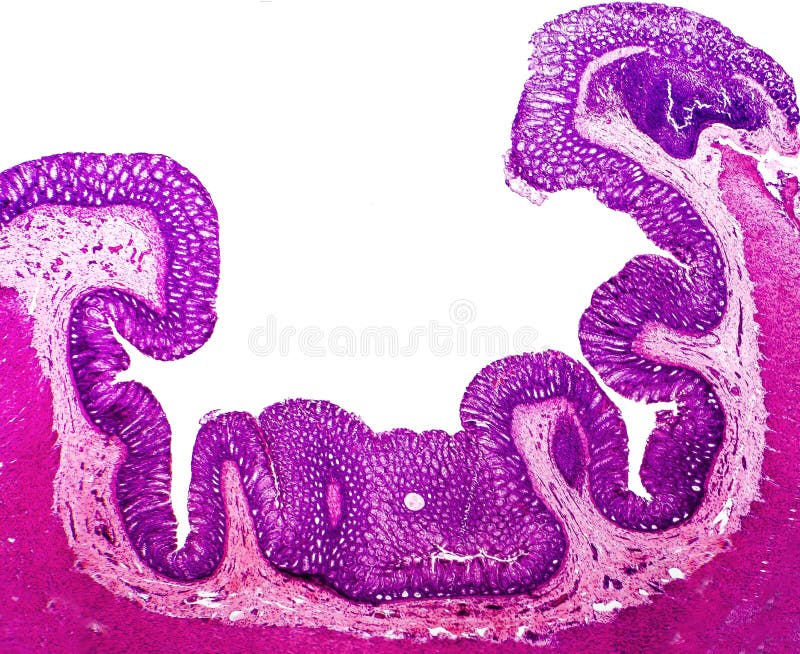 Small Intestine. Intestinal Villi Stock Photo - Image of light, goblet ...