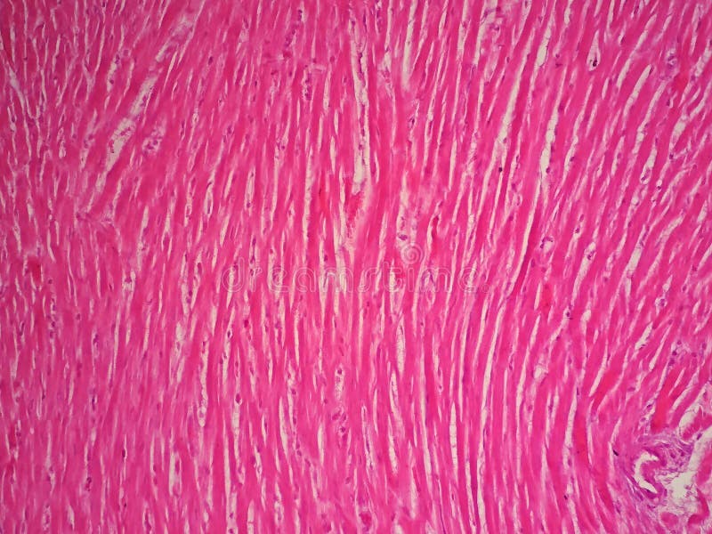 Histology Aorta Photos - Free & Royalty-Free Stock Photos from Dreamstime