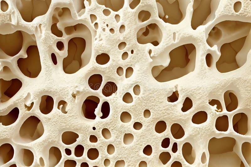 Bone Under Microscope Stock Illustrations – 33 Bone Under Microscope ...