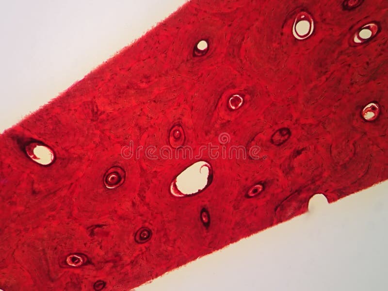 Histology of Human Compact Bone Tissue Stock Image - Image of medicine ...
