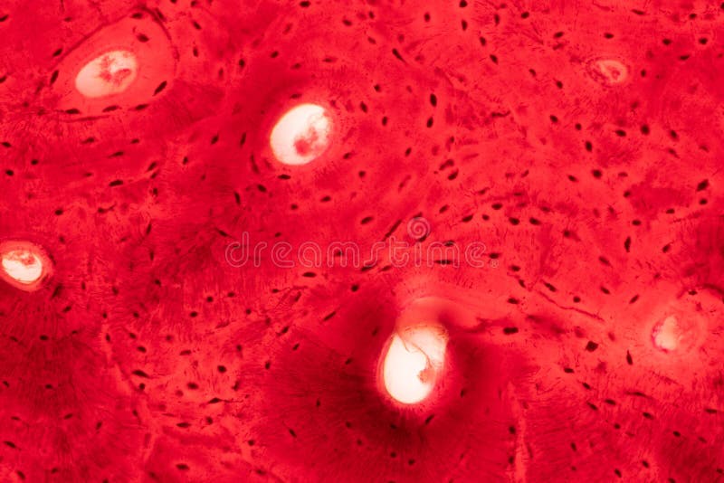 Histology of Human Compact Bone Tissue Under Microscope View for Stock ...