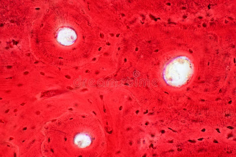 Histology of Human Compact Bone Tissue Under Microscope View for Stock ...