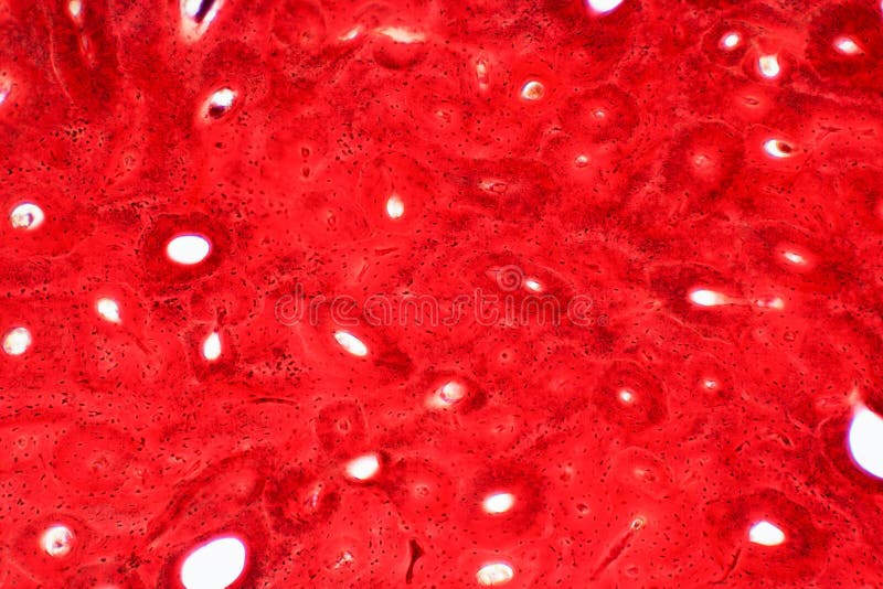 Histology of Human Compact Bone Tissue Under Microscope View for Stock ...