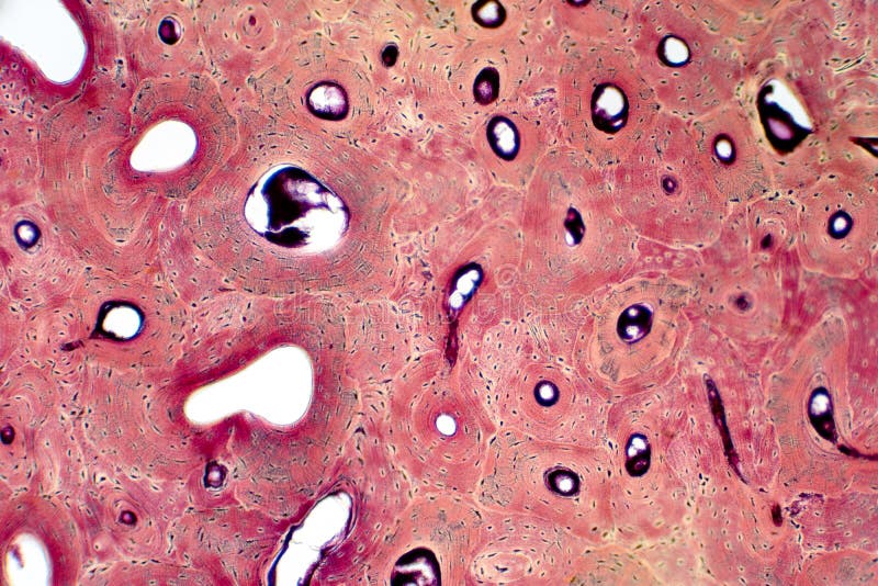 Histology of Human Compact Bone Tissue Under Microscope View for ...