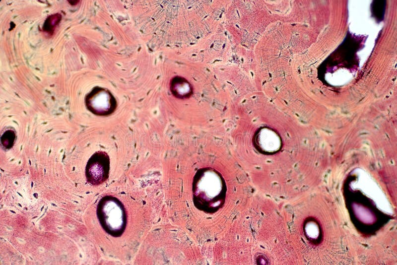 Histology of Human Compact Bone Tissue Under Microscope View for ...