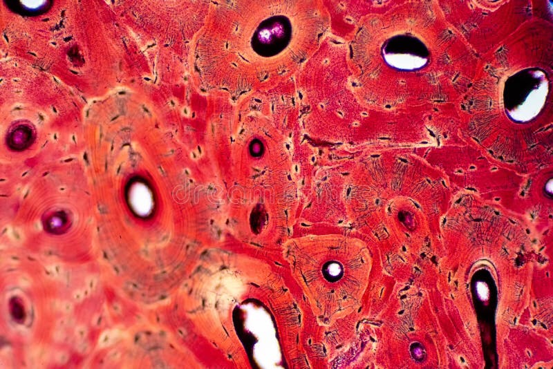 Histology of Human Compact Bone Tissue Under Microscope View for Stock ...
