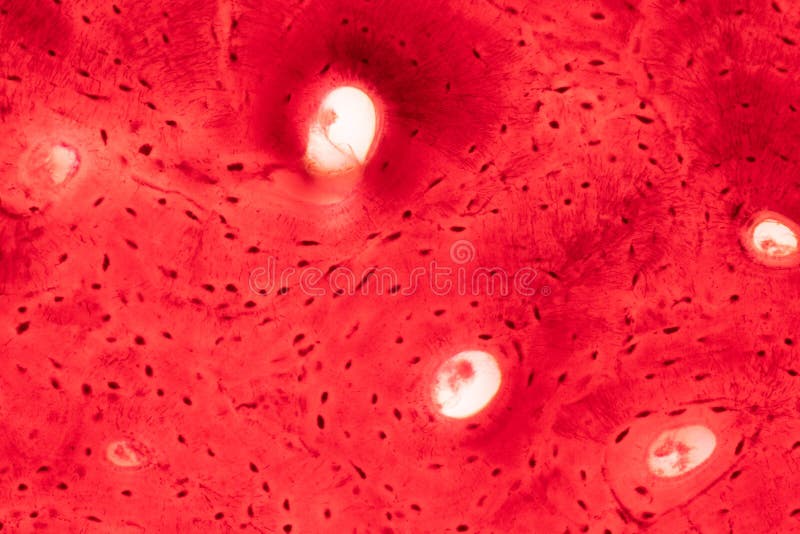 Histology of Human Compact Bone Tissue Under Microscope View for Stock ...