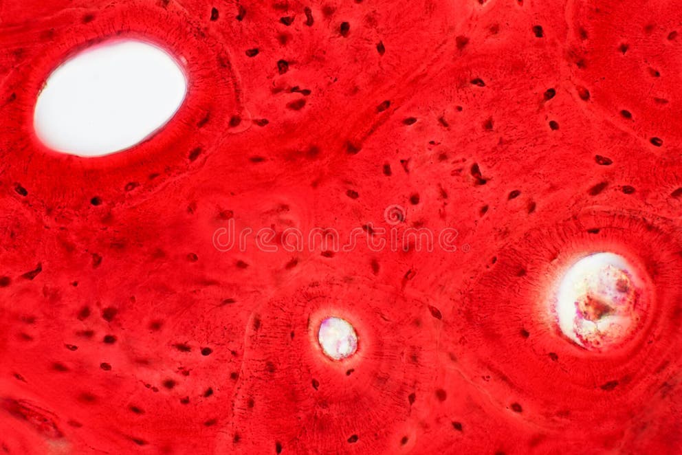 Histology of Human Compact Bone Tissue Under Microscope View for Stock ...
