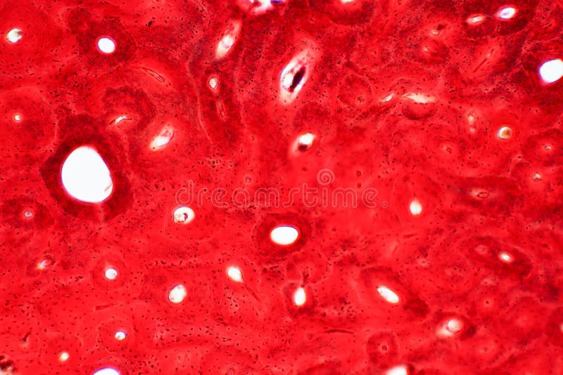 Histology of Human Compact Bone Tissue Under Microscope View for Stock ...