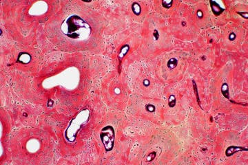 Histology of Human Compact Bone Tissue Under Microscope View for Stock ...