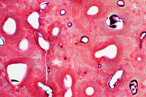 Histology of Human Compact Bone Tissue Under Microscope View for Stock ...