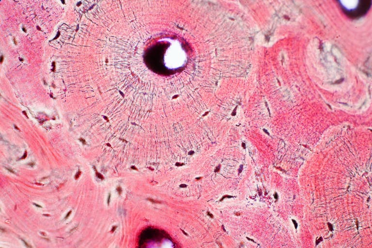 Histology of Human Compact Bone Tissue Under Microscope View for Stock ...