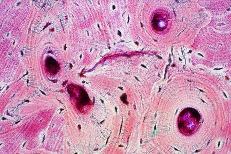 Histology of Human Compact Bone Tissue Under Microscope View for Stock ...