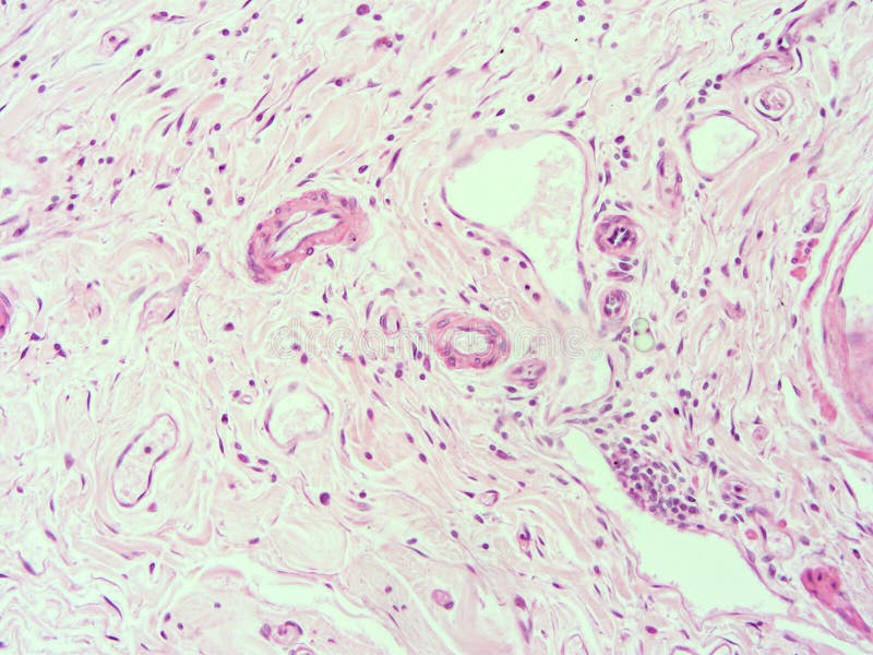 Histology of Human Gallbladder Tissue Stock Image - Image of ...