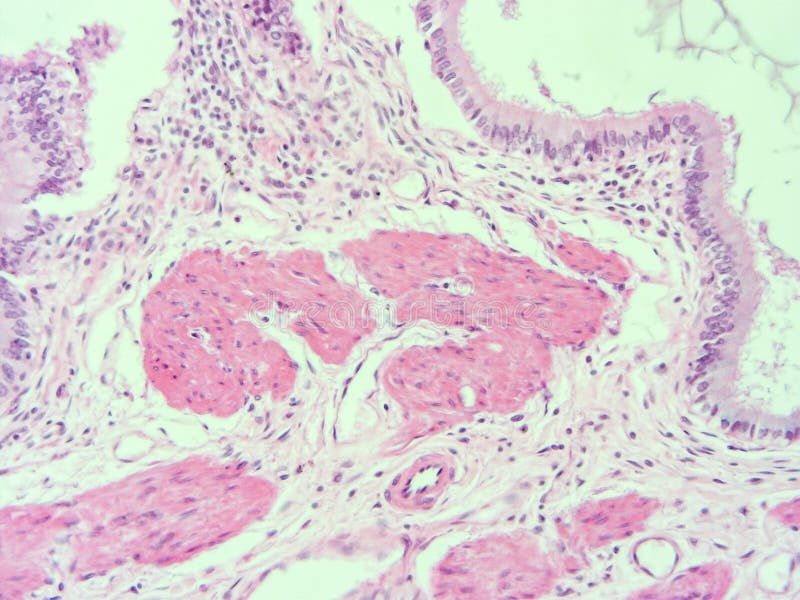 Histology of Human Gallbladder Tissue Stock Image - Image of physiology ...