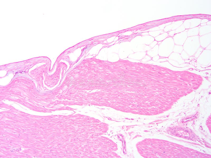 Histology of Human Heart Muscle Tissue Stock Photo - Image of pathology ...