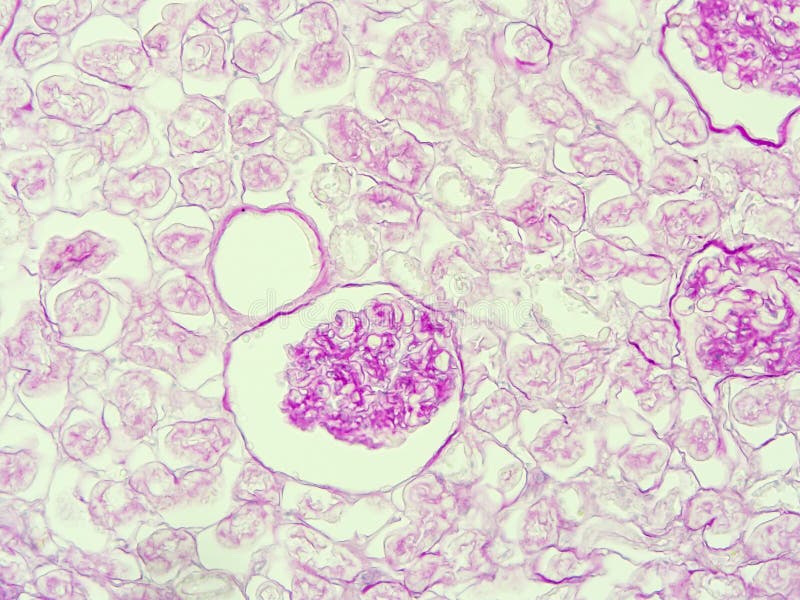 Histology of Human Kidney Tissue Stock Image - Image of tissue ...