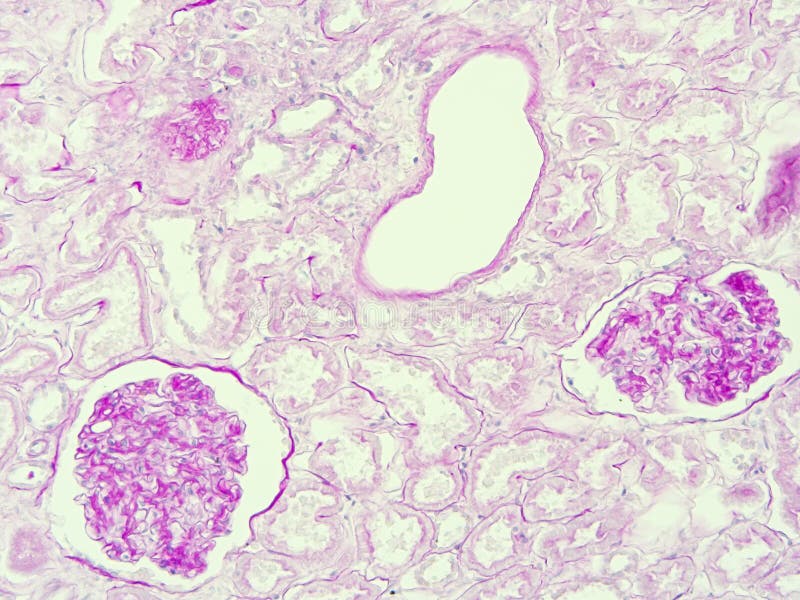 Histology of Human Kidney Tissue Stock Photo - Image of gland, cell ...