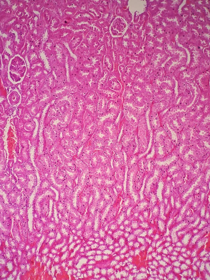 Histology of human kidney stock image. Image of anatomy - 89484499