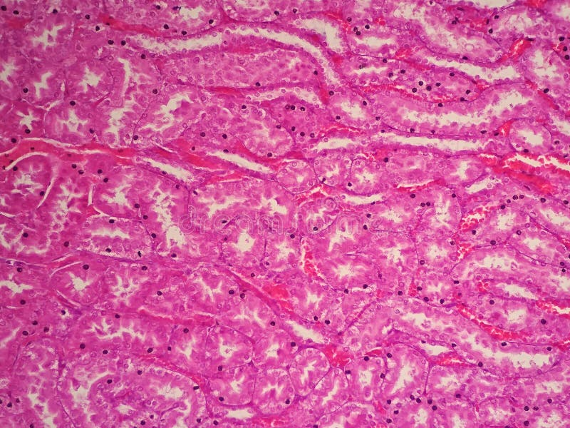 Histology of human kidney stock image. Image of medulla - 89484509