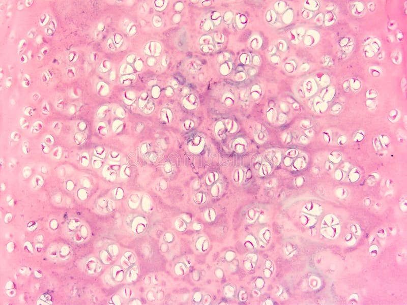 Histology of Human Larynx Tissue Stock Image - Image of squamous ...