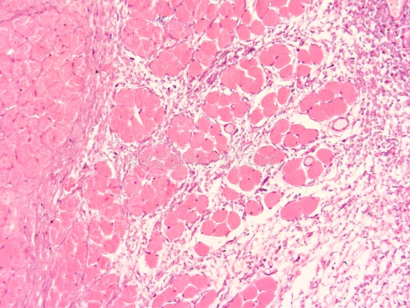 Histology of Human Larynx Tissue Stock Image - Image of microscopy ...