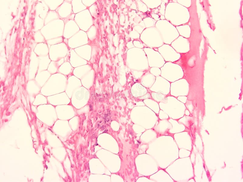Histology of Human Larynx Tissue Stock Image - Image of connective ...