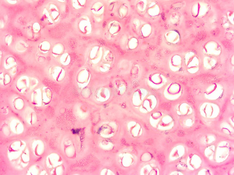 Histology of Human Larynx Tissue Stock Photo - Image of human, doctor ...